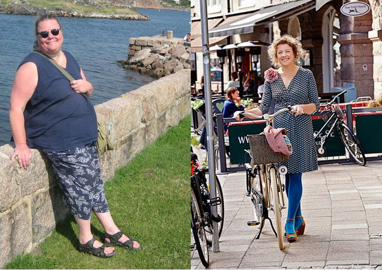 AspireAssist - новое устройство для похудения